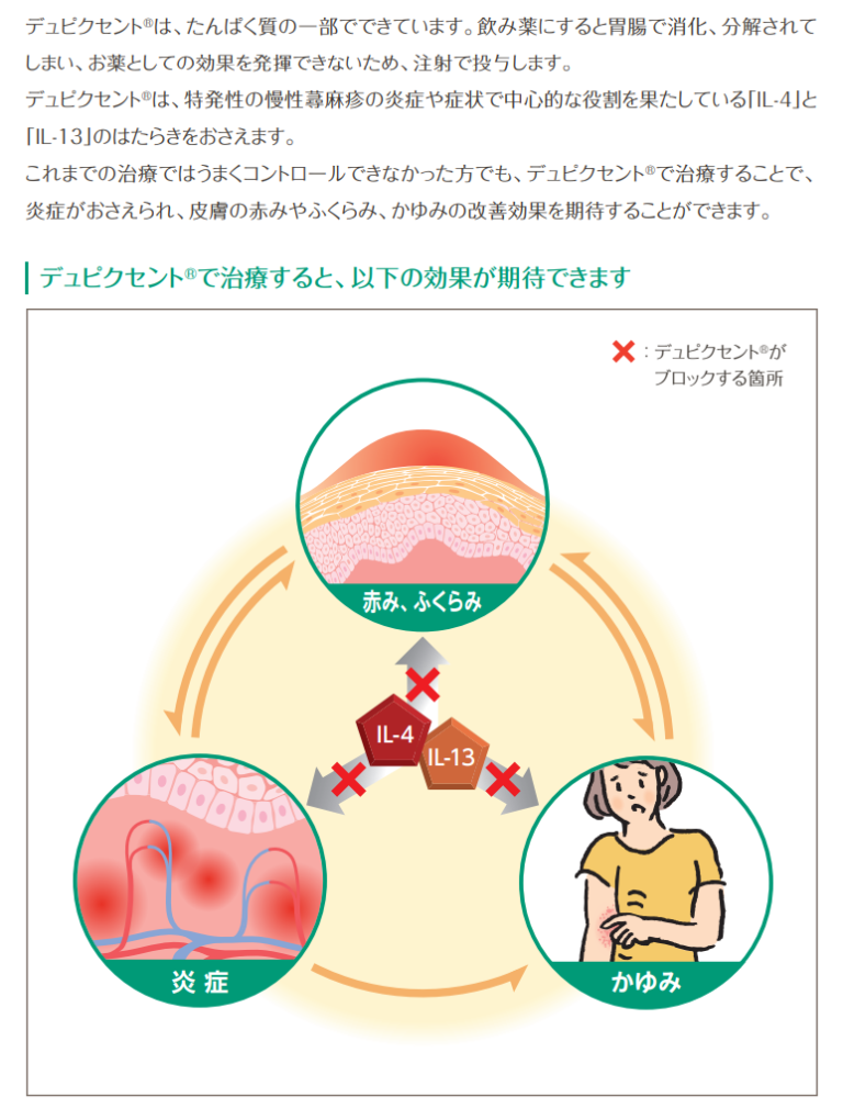 慢性特発性じんま疹の治療法～デュピクセント®・ゾレア®～ | 門前仲町駅徒歩4分、江東区永代の魚住総合クリニック｜整形外科・リハビリ科・内科・皮膚科